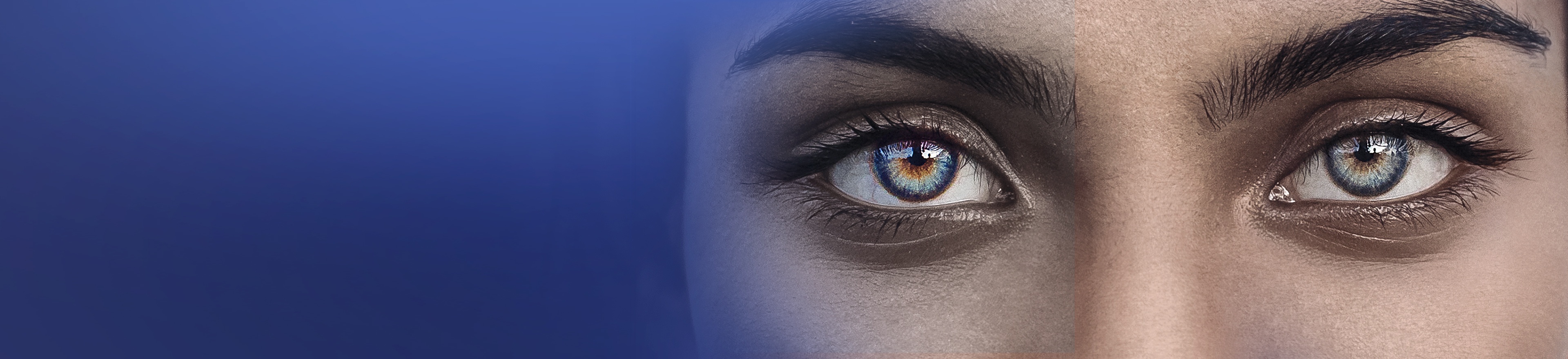 EYEMUSE™ - Clinically Studied Paraprobiotic for Eye Health